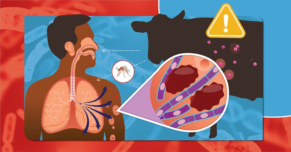 Anthrax Uncovered - SES